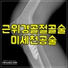 염창동 정형외과 근위경골절골술 단점과 수술의 위험성 및 합병증 제이본정형외과 권제호 네이버 블로그